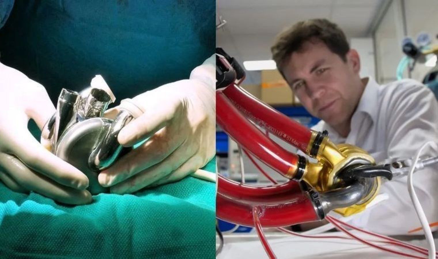 Yapay Kalp Ameliyatıyla Tıbbi Dönüm Noktası – Son dakika Haberleri ...